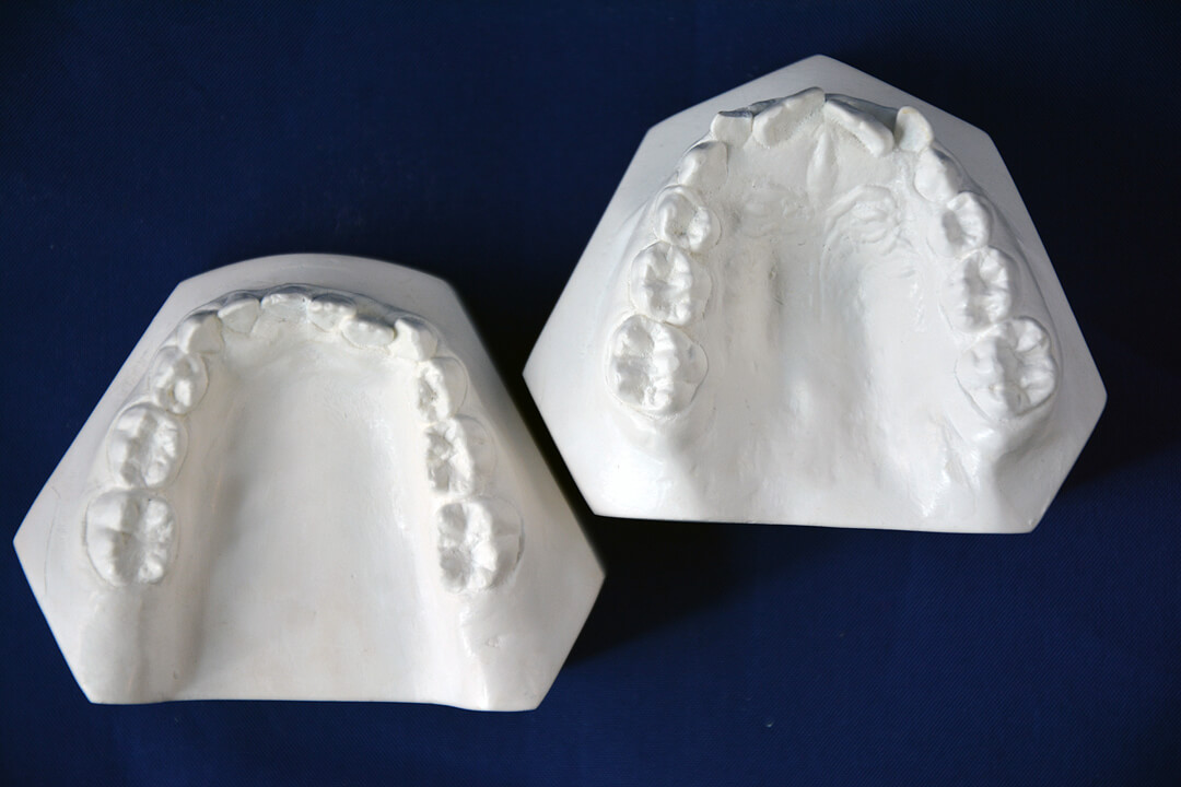 dentition mixte | GDT